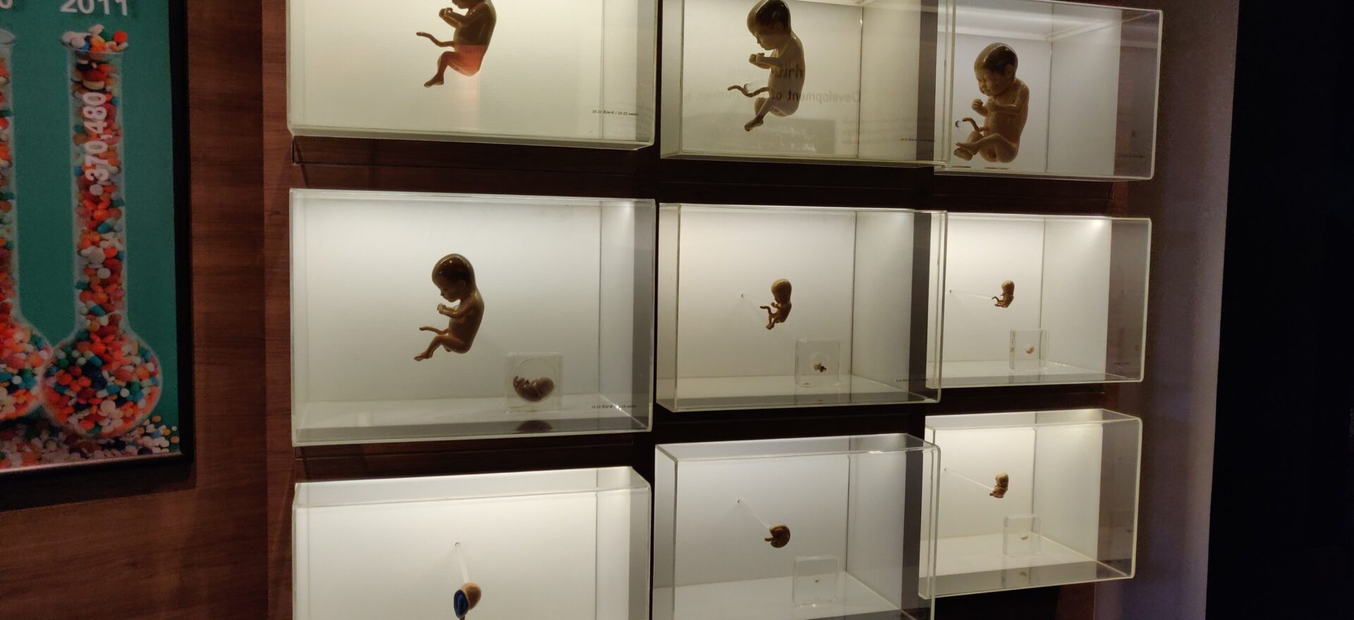 Siriraj Medical Museum : Bangkok | Visions of Travel